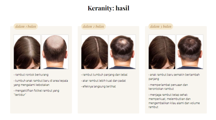 Keranity Hair Serum Harga Indonesia: Dapatkan diskon 50%